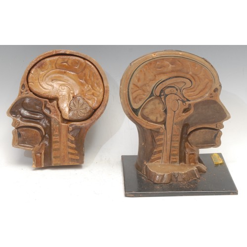 Adam Rouilly (Medical Interest) - a mid-century composite plastic ...