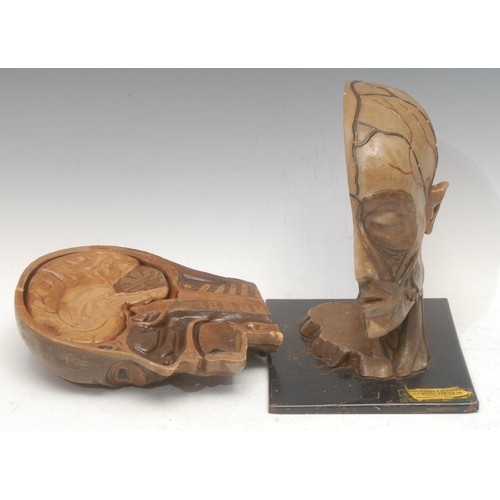 Adam Rouilly (Medical Interest) - a mid-century composite plastic ...