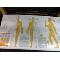 2 acupuncture posters